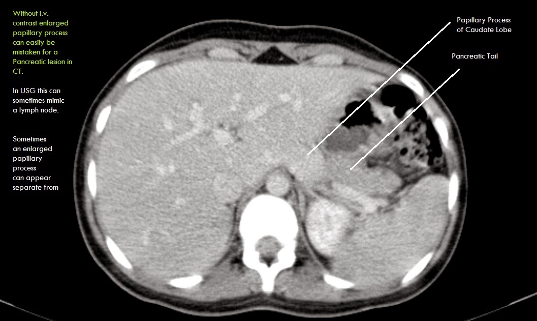 Ultimate Radiology : August 2014