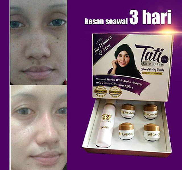 ALINBEAUTYCARE: TATI SKIN CARE