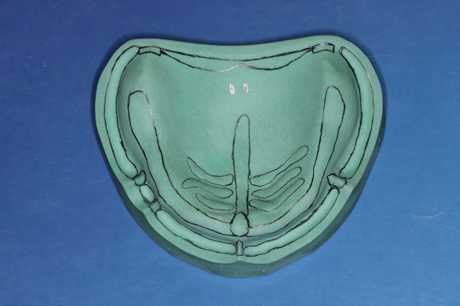 Understanding Prosthodontics - Tagore Dental College & Hospital-By ...