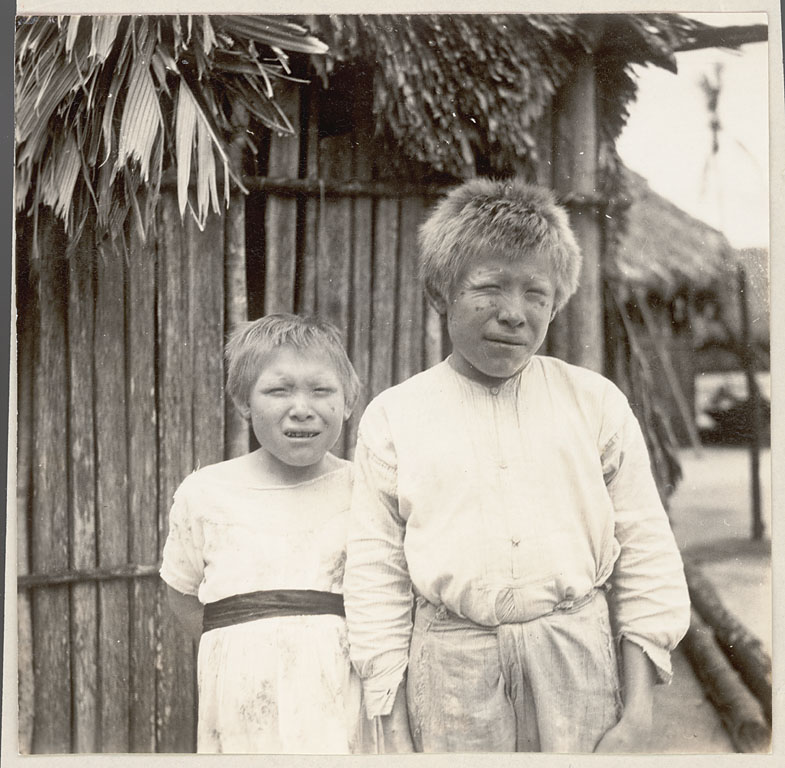 Deformutilation: Albinism Among The Kuna Indians