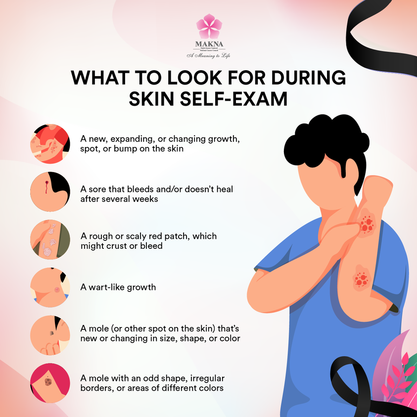 National Cancer Society of Malaysia, Penang Branch: Skin Cancer : What ...