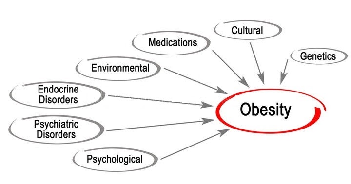 Obesity Treatment: Obesity: Classification, Symptoms and Causes