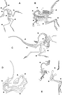 opisthotonus - USA News Collections