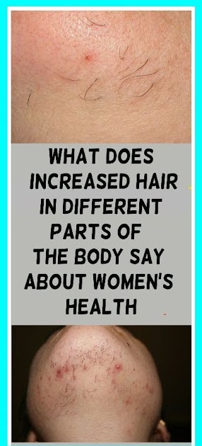 What Does Increased Hair In Different Parts Of The Body Say About Women ...