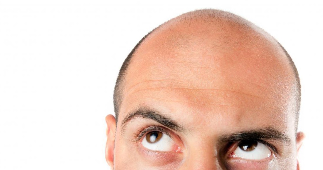 Macam mana kepala boleh botak? - Rancak TV