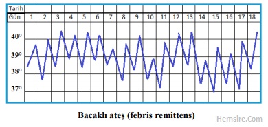 Ateş tipleri ve grafikleri