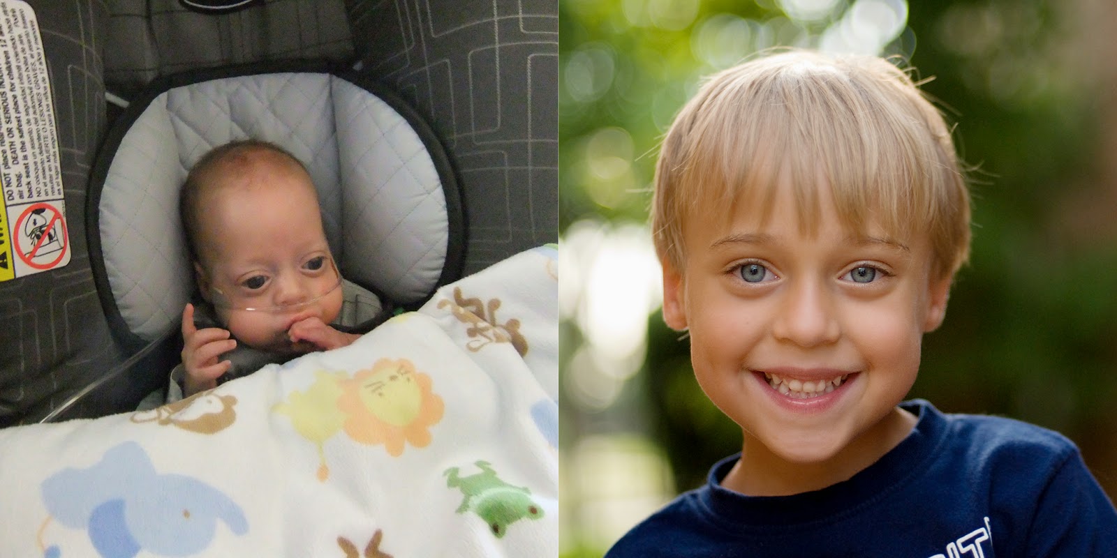 Parenting the Preemie Pope: Toaster-Headed Baby