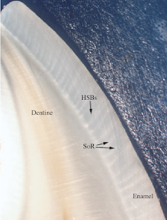Tooth Enamel- Composition, Properties, Structure and Functions