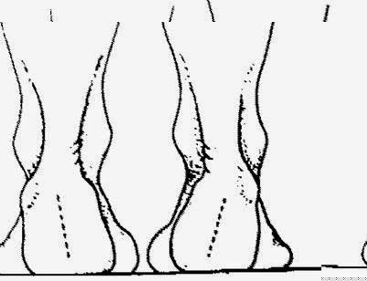 Biomecanica y ortopedia del pie