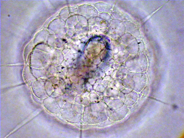 Beyond the Human Eye: Swallowed by the Sun Animacule