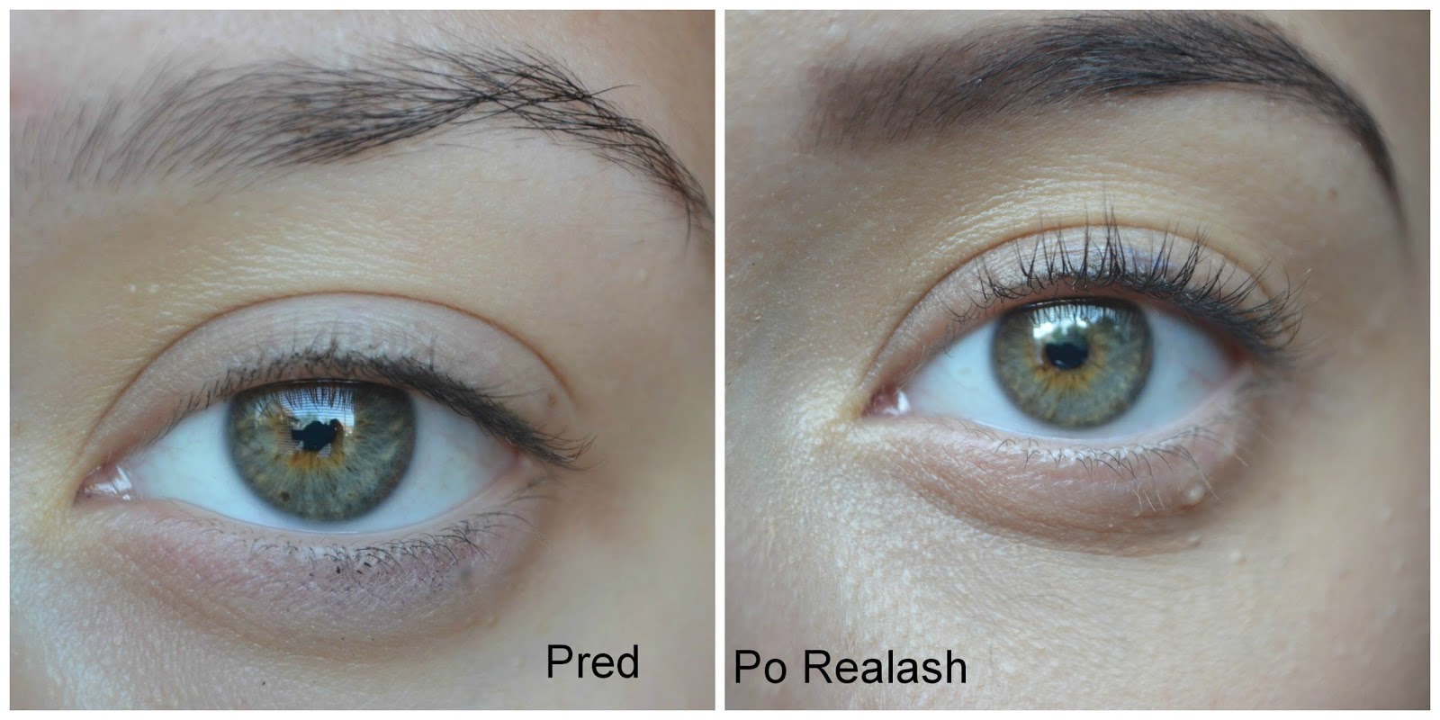 Realash sérum na riasy