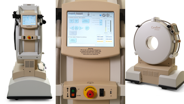 CT SCANNER PORTABLE FULL BODY 32 SLICE: OTOSCAN
