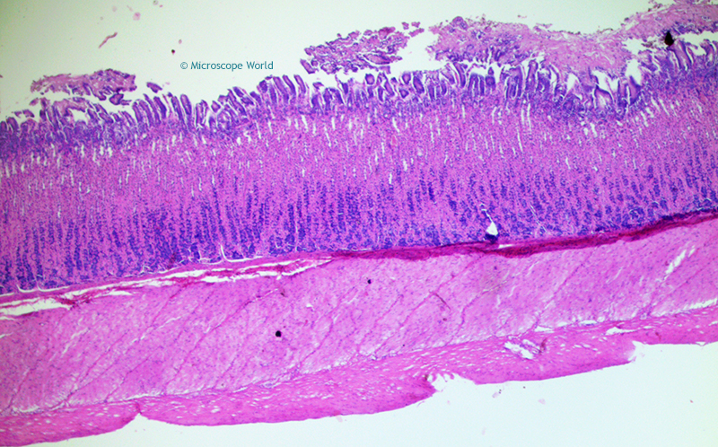 Fundus Stomach