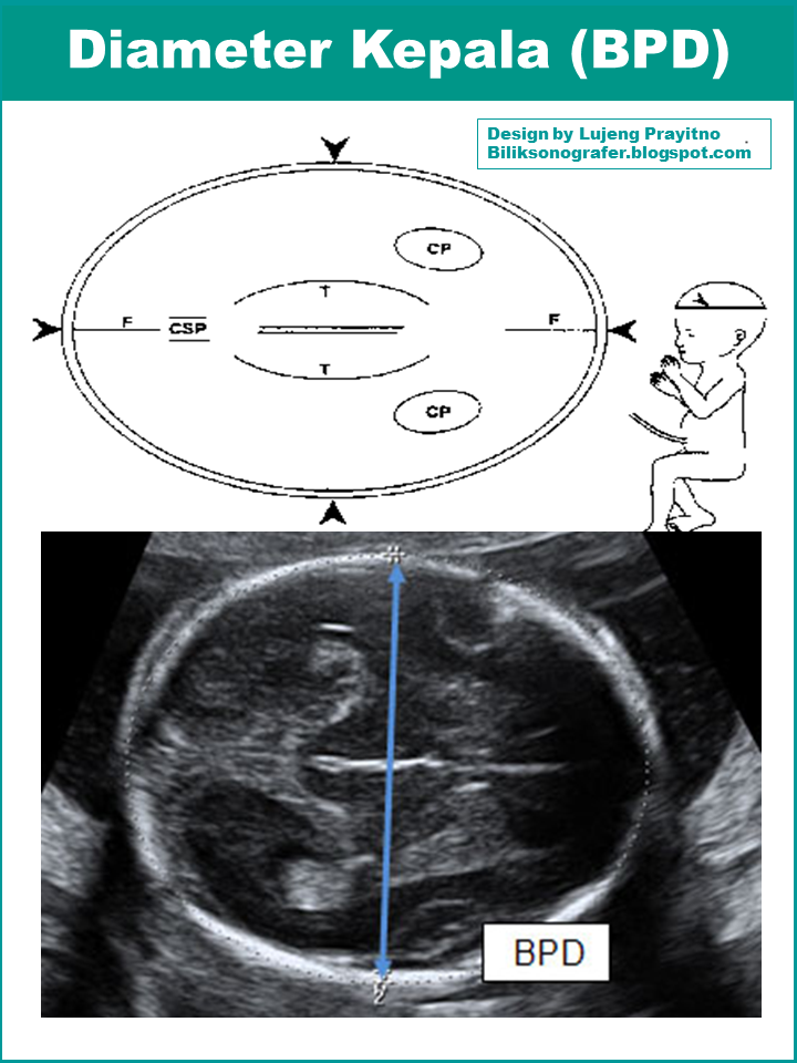 Pemeriksaan Ultrasonografi (USG) Trimester 2/3