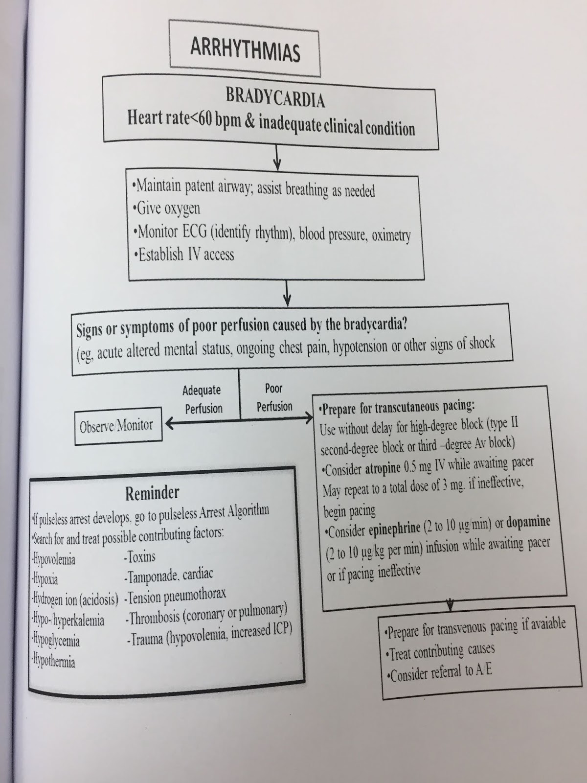 BRADY ARRHYTHMIA ALGORITHM
