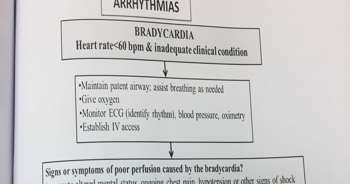 BRADY ARRHYTHMIA ALGORITHM