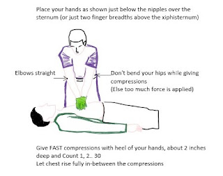 Medicowesome: CARDIOPULMONARY RESUSCITATION (CPR)