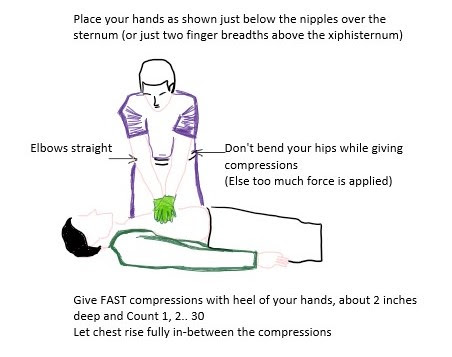 Medicowesome: CARDIOPULMONARY RESUSCITATION (CPR)