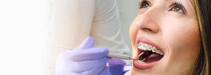 Kelly Orthodontics: Preparing For Orthodontics