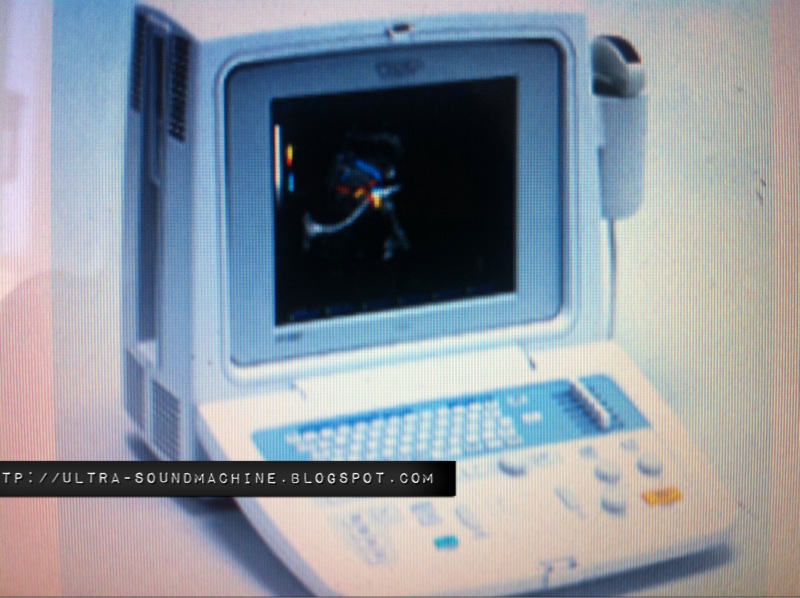 Ultra Sound Machine: Diagnostic Ultrasound Imaging Equipment FF sonic ...