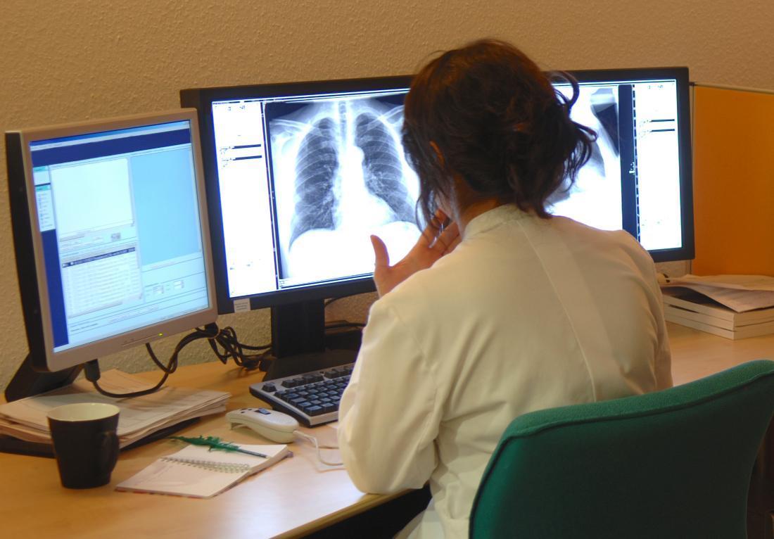 Lung Cancer - Classification, Stages, Symptoms, Causes, Effects ... Lung Cancer - Classification, Stages, Symptoms, Causes, Effects ...