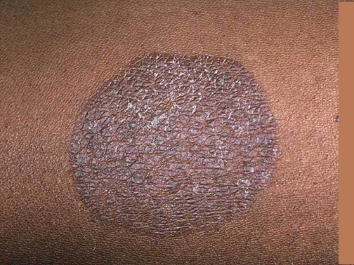 EL RINCÓN DE LA MEDICINA INTERNA