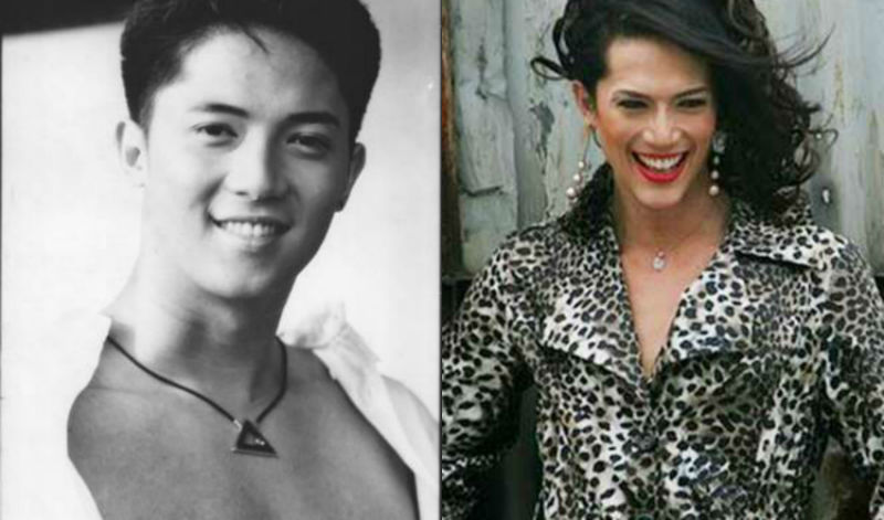 5 Artists Who Admitted To Have Undergone Plastic Surgery - News Info PH
