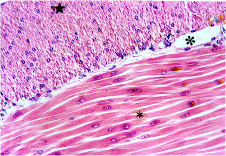 Biologia 1º Bcho CCNN José Ferrándiz Miguel López: Tejido muscular liso