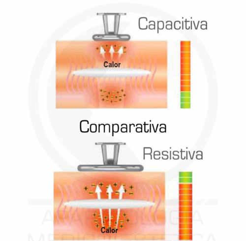 Radiofrecuencias. Clasificación.