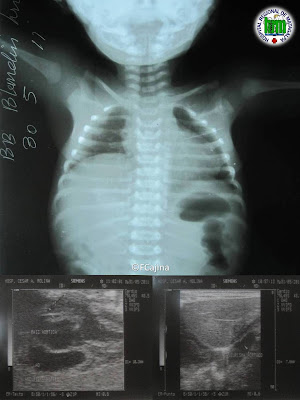 Dr. Frank Cajina Gómez: Atlas de Defectos Congénitos HECAM