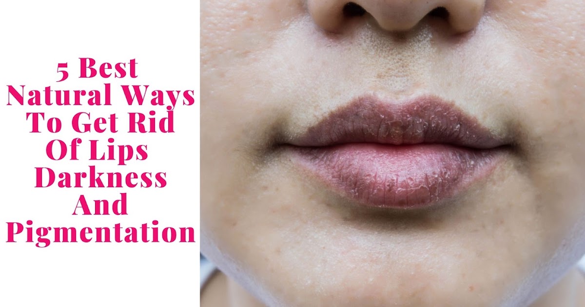 5 Best Natural Ways To Get Rid Of Lips Darkness And Pigmentation 5-best-natural-ways-to-get-rid-of-lips-darkness-and-pigmentation