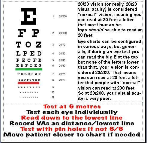 Grade 7 Health: Snellen chart