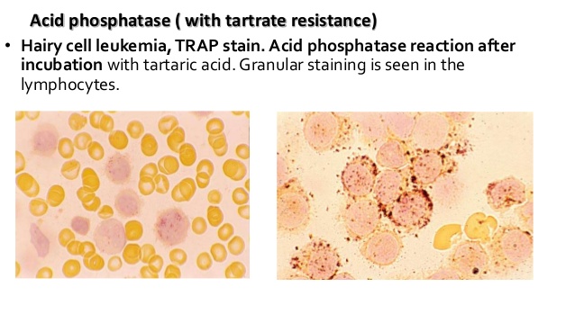 Lecture Notes in Medical Technology: Lecture #14: Blood Cell Cytochemistry