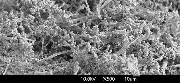Chronic Kidney Diseases: Mycotoxin-Induced Chronic Kidney Disease