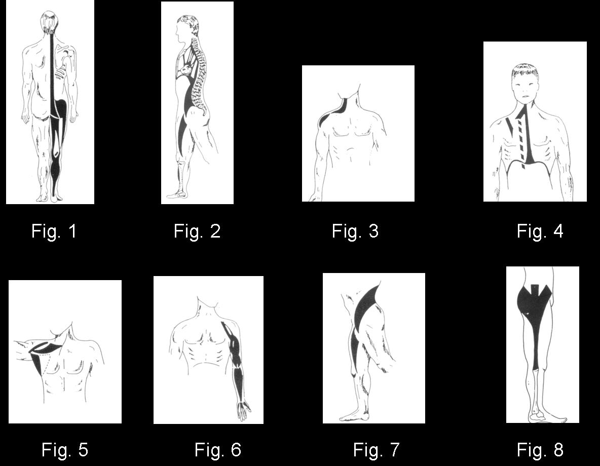 Ignacio Sotelino. Lic. Kinesiólogo Fisiatra - RPG: Cadenas Musculares ...