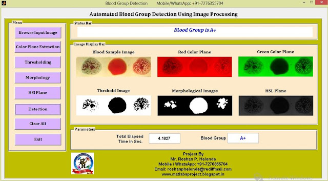 Matlab Code for Blood Group Detection Using Image Processing ~ Matlabs Code