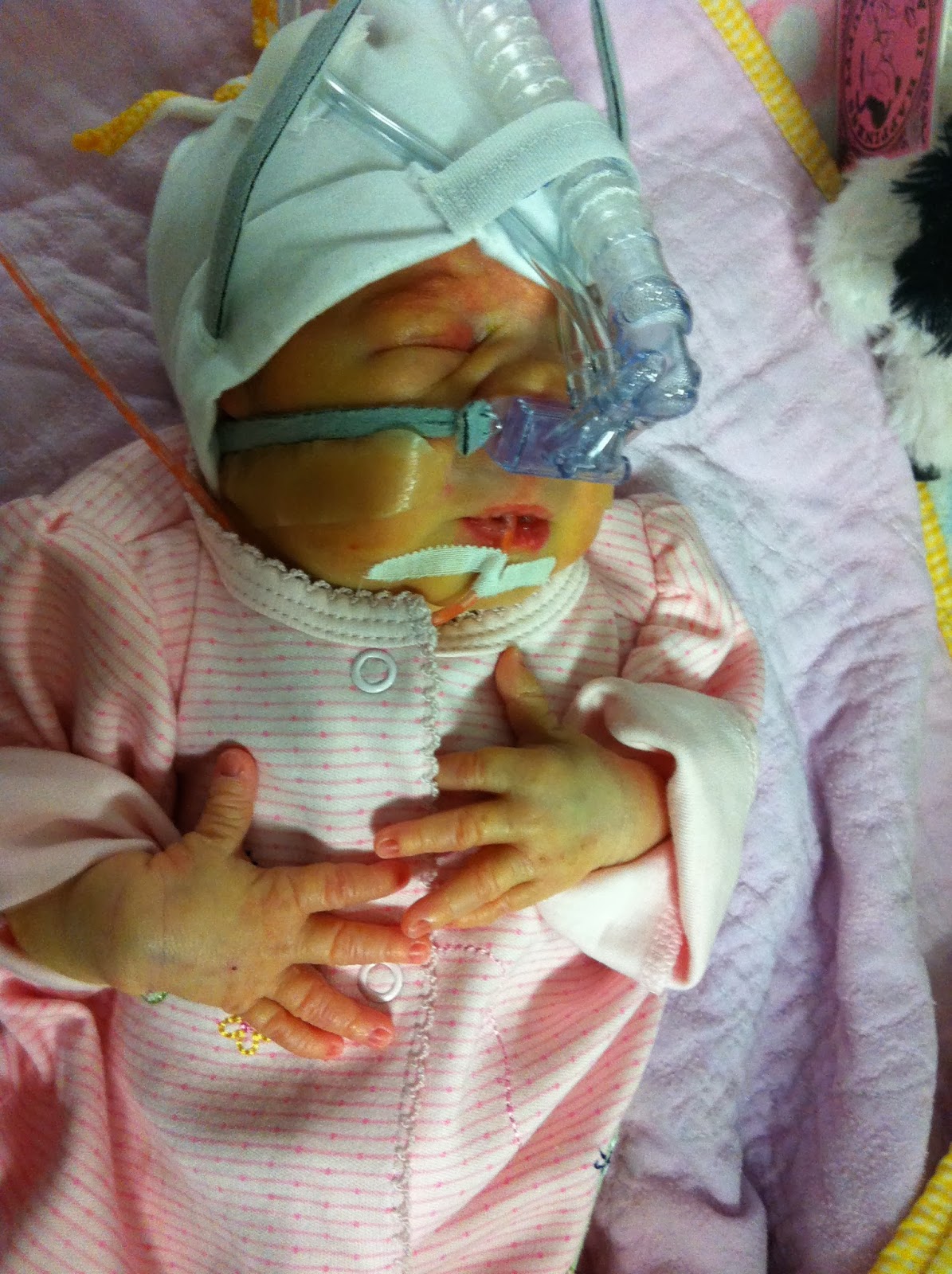 Savannah: 13 Stories of Trisomy 13 | Still Playing School