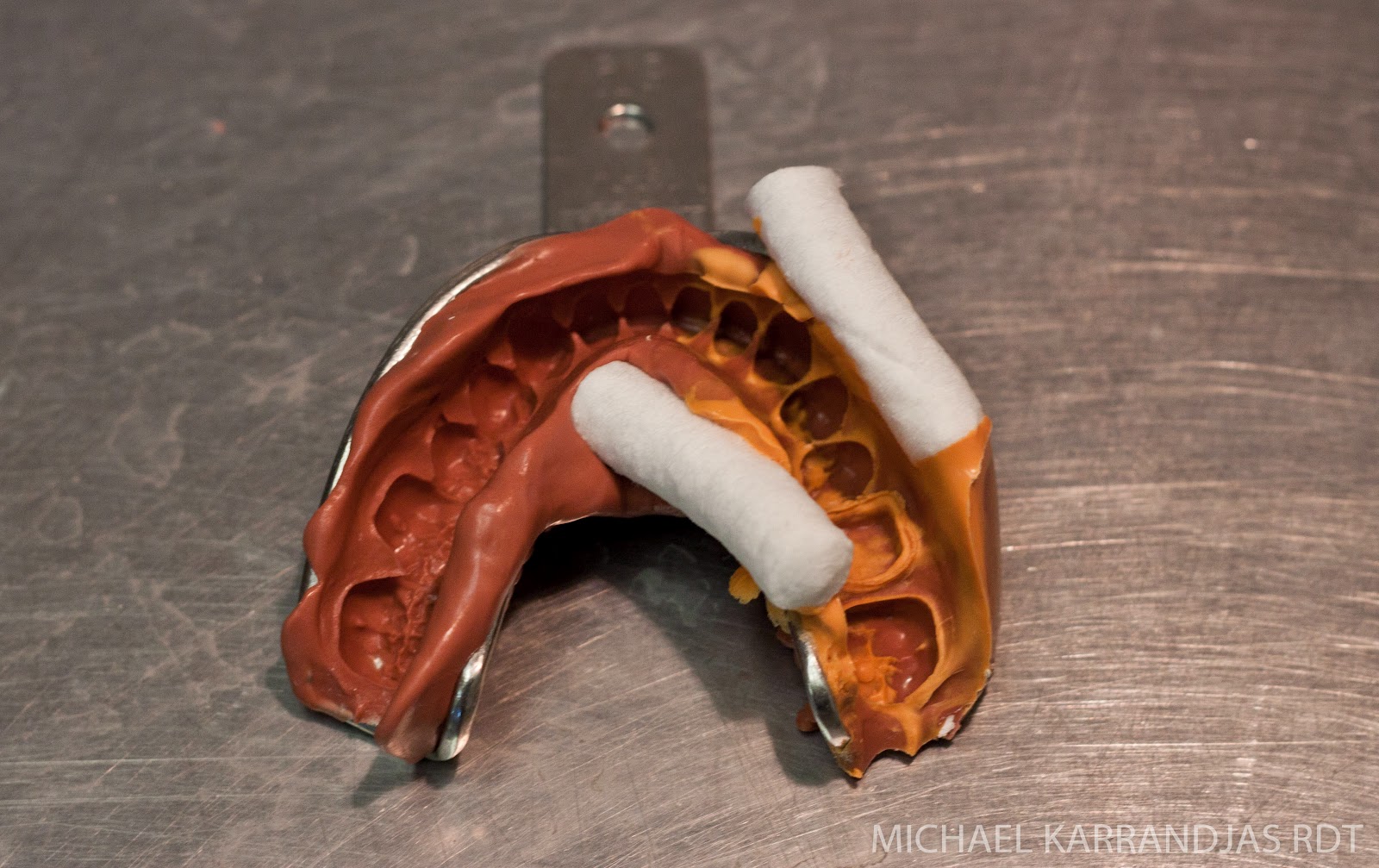Dental Lab Model Pouring | Making Noise And Drinking Beer