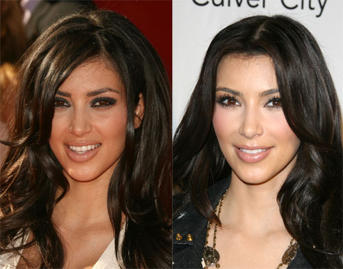 Kim Kardashian Plastic Surgery Before And After - Plastic Celebrity Surgery