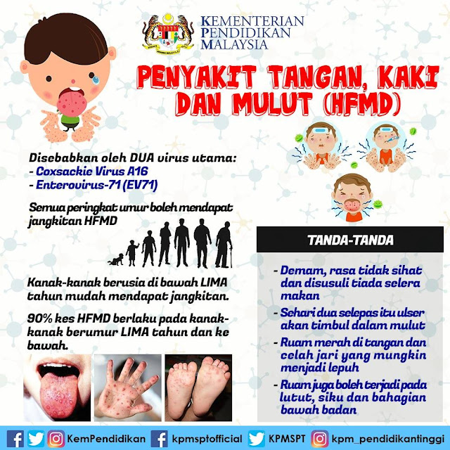 Infografik Kesedaran Penyakit Tangan, Kaki Dan Mulut (HFMD)