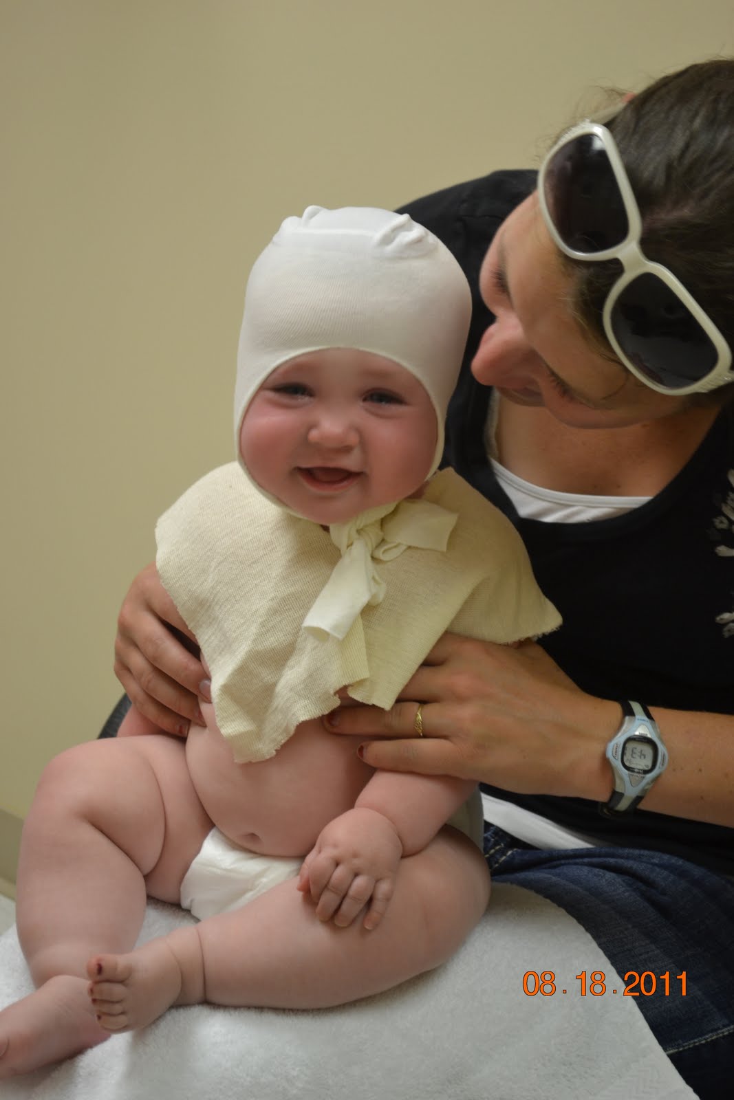 The Millward Family: My baby has a jacked up head