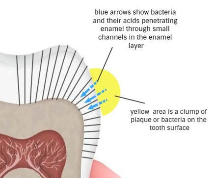 Tooth Enamel- Composition, Properties, Structure and Functions