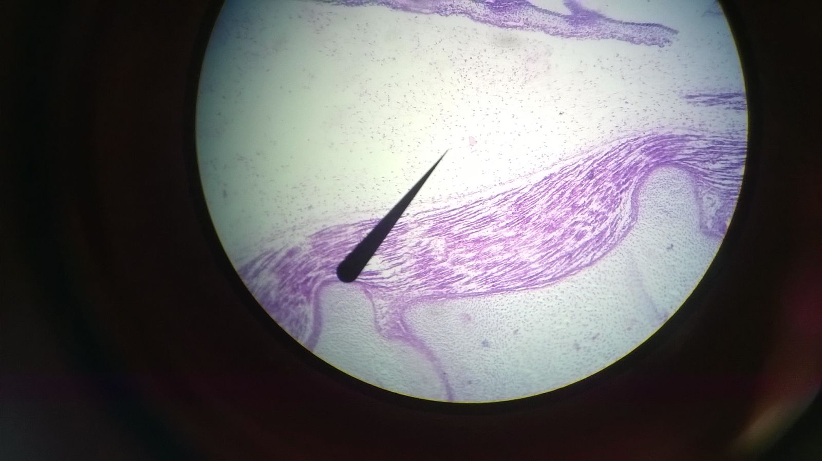 Histología: Tejido Conjuntivo Laxo