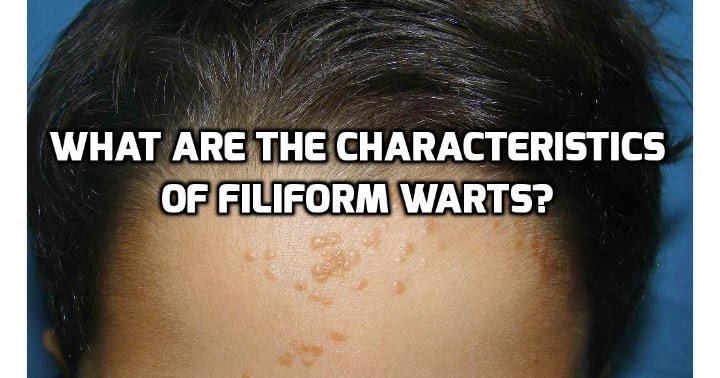 How To Have a Healthy Life: Revealing Here 10 Important Facts about ...