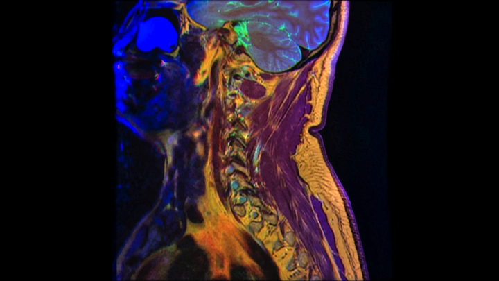 The Styrous® Viewfinder: Nikola Tesla & the MRI