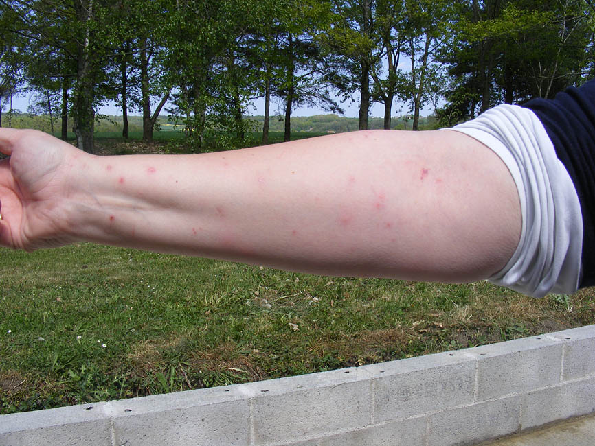 Loire Valley Nature: Pine Processionary Moth - Thaumetopoea pityocampa