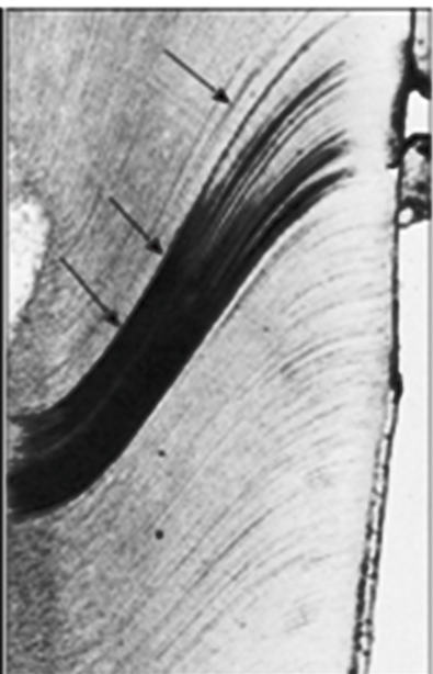 Dentin- Microscopic Structure, Properties, Types and Functions