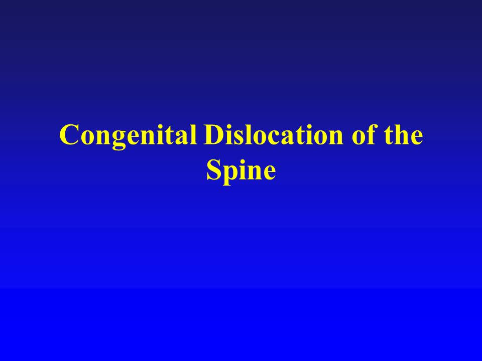 Congenital Spine Dislocation | Growing Spine Blog | Washington ...
