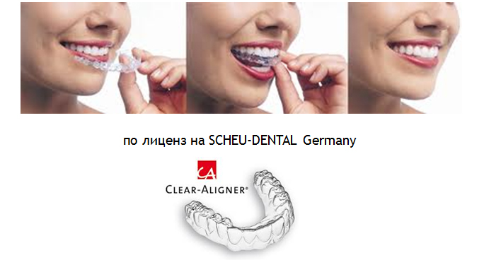 Функционални ортодонтски апарати ~ Медико-техническа ортодонтска ...