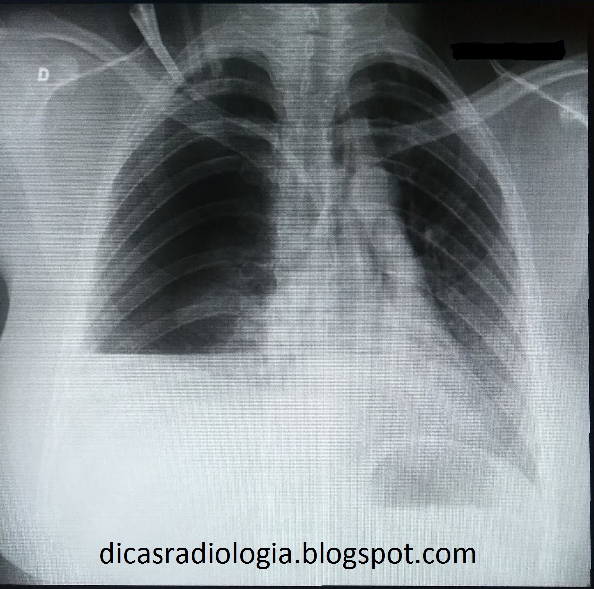 DICAS DE RADIOLOGIA - Tudo Sobre Radiologia: PRINCIPAIS DOENÇAS ...
